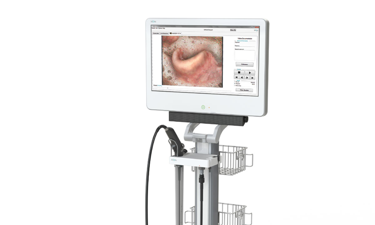 Endoscopy - DP Medical